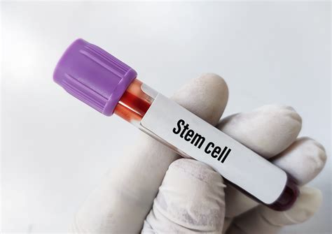 Stem Cell Pengertian Jenis And Cara Kerja Dalam Dunia Medis