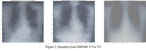 Figure 2 From Generating Synthetic Chest X Rays With Generative Modeling Semantic Scholar