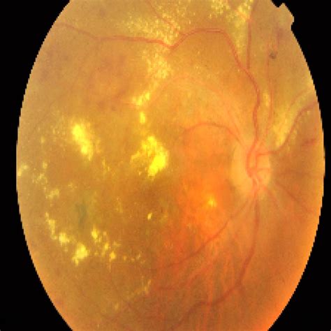 Custom Workflow Single Label Classification Classification Dataset By Final Year Project Fyp