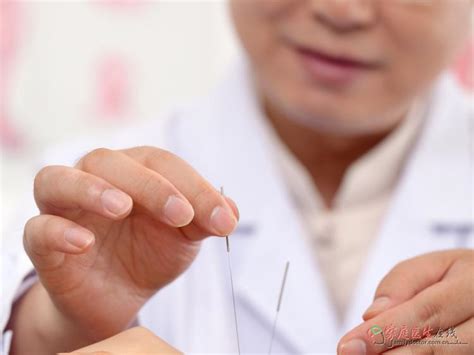 Ai与针灸融合：健康养生领域新探索 家医健康