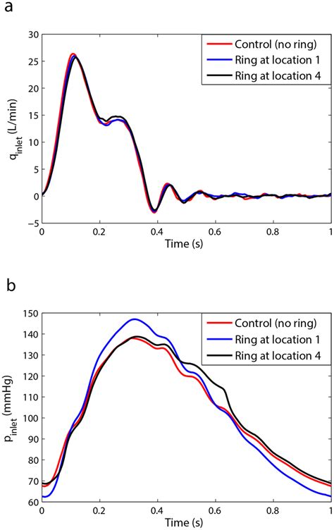 Samples Of Hemodynamic Waveforms For Ring Experiment A Samples Of