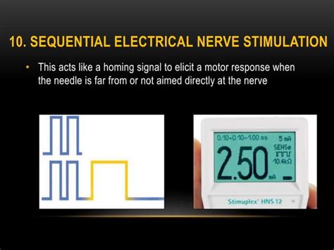 Basics Of Peripheral Nerve Stimulation Pptx First Aid Injuries