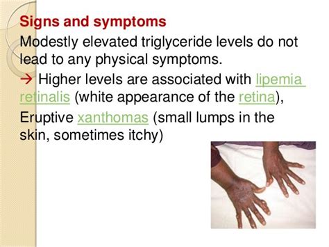 Hypertriglyceridemia