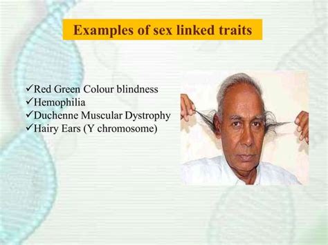 Sexinfluence Sex Linked And Sex Limitedtraits Pdf