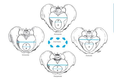 Clasificación Anatómica De La Pelvis Caldwell Moloy
