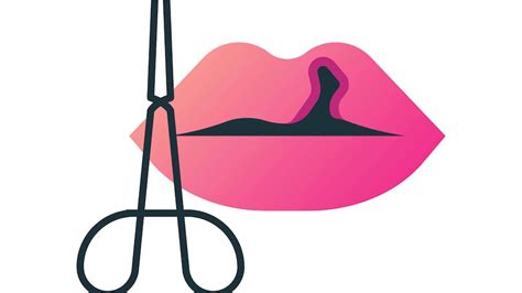 Xcode Life On Linkedin Cleft Lip And Palate Causes Genetics Inheritance And Outlook