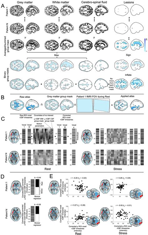 Within Participant Stress Responsivity And Functional Connectivity