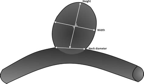 Definition Of The Aneurysm Size Measurements Download Scientific Diagram