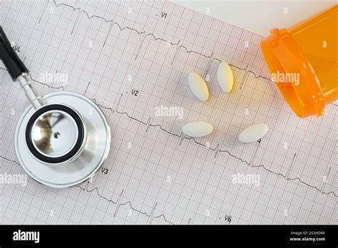 Electrocardiogram Ecg Ekg Printed Report Graph With Medication And