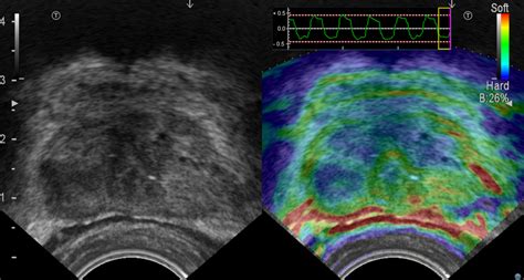 Urology Fujifilm [singapore]