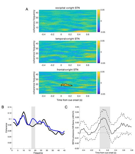 Increased Coherence Between Right Frontal Cortex And Right Stn During Download Scientific Diagram