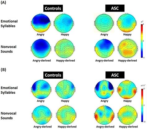 The Mmn Scalp Potential Distribution And The Respective Current Source