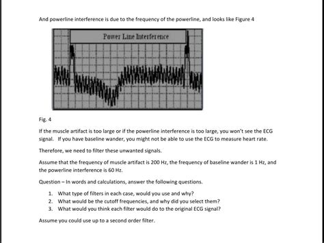 Solved An ECG Looks Like A Triangular Waveform And Is Shown Chegg