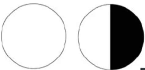 Compressive Visual Field Defects Eyewiki