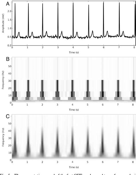 Figure 1 From A General Description Of Linear Time Frequency Transforms