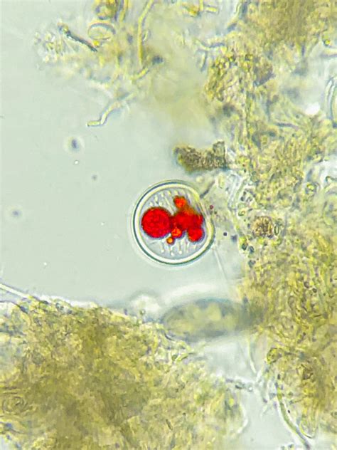 Red Algae Under Microscope Sheathia Rosemalayensis