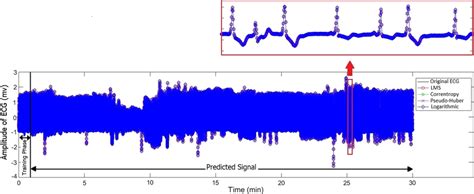 predicted ecg signal of record 223 of mitdb arrhythmia database using