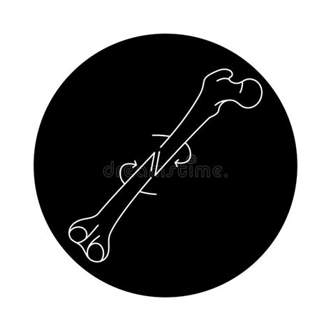 Spiral Bone Fracture Line Icon Stock Vector Illustration Of Greenstick Cartilage 331693669