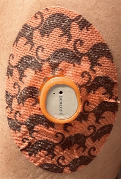Removing Dexcom G7 Sensors R Dexcom