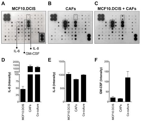 Cancers Free Full Text Paracrine Activation Of Stat3 Drives Gm Csf Expression In Breast