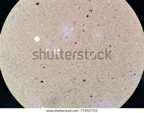 Cryptococcus Spp On Indian Ink Stain Stock Photo Edit Now 773927725