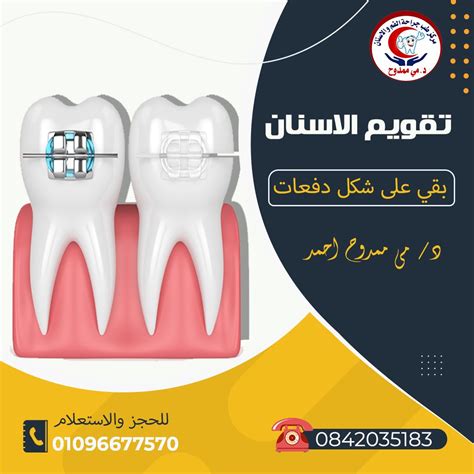 مركز الدكتورة مى ممدوح احمد صرير الاسنان عند الاطفال 🥶🥶 هو احتكاك