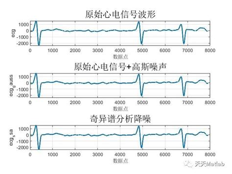 【心电信号去噪】基于奇异谱svd算法ecg信号去噪附matlab代码 奇异值分解算法 svd 对胎儿心电信号进行去噪 csdn博客