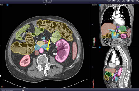 Deep Learning Exhibit Ctisus