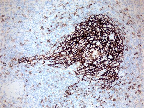 Cd23 Antibody Lexicon