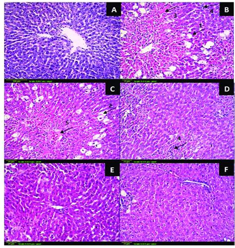 Effect Of P Niruri Ae On Rats Liver Histopathology After Acute Ccl 4