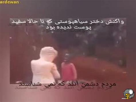 سفیدترین دختر جهان در حقیقت سیاهپوست زاله فیلو