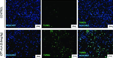 Apoptotic Cells Stained With Tunel Label Green In Brain Slices Of