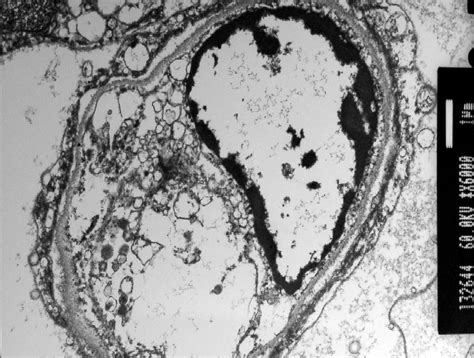 Electron Micrograph Endotheliocyte Pulmonary Capillary Nucleus Download Scientific Diagram