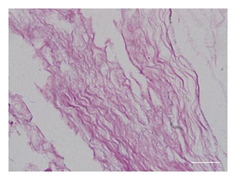 Perfusion Decellularization Of Murine Pancreas Gross Picture A Download Scientific Diagram