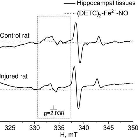Epr Spectrum Of Hippocampus Tissues Of The Control Control Rat And