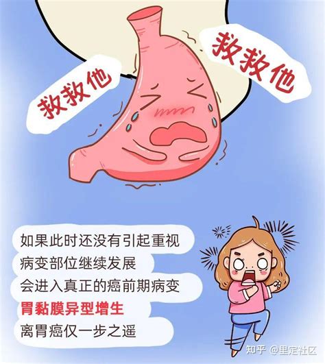 如何打赢“保胃战” 知乎