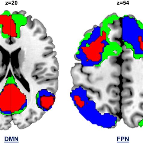Resting‐state Networks For Patient Groups And Controls Resting‐state Download Scientific