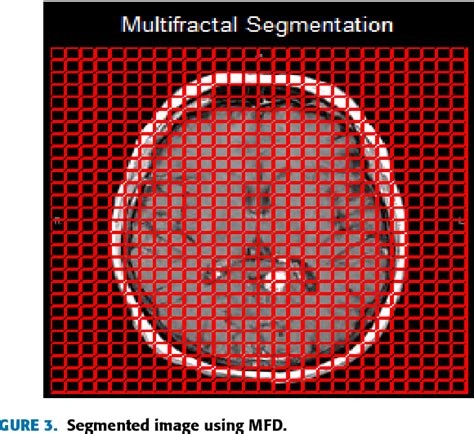 Figure 3 From Neural Network Based Brain Tumor Detection Using Wireless