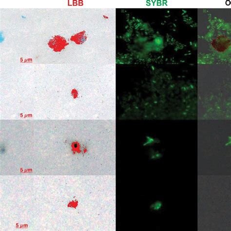 Setting The Parameters For Color Threshold Using The Color Threshold Download Scientific