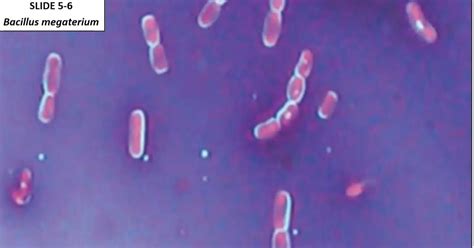 Capsule Staining By Manevals Method ~ Biotechfront