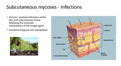 Mycology Subcutaneous Mycoses Flashcards Quizlet