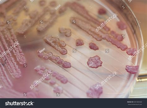 Escherichia Coli Colonies Test On Macconkey库存照片581089360 Shutterstock