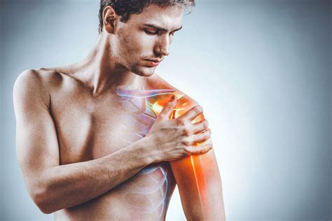 Chiropractic And Neuralgic Amyotrophy A Case Report Australian Spinal Research Foundation