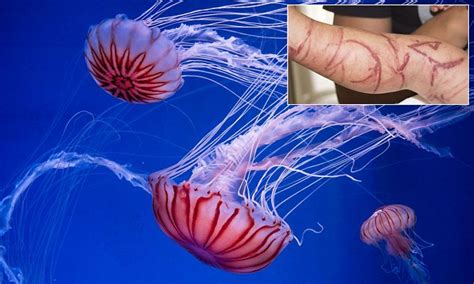 Peeing To Relieve A Jellyfish Sting Is A Myth Daily Mail Online