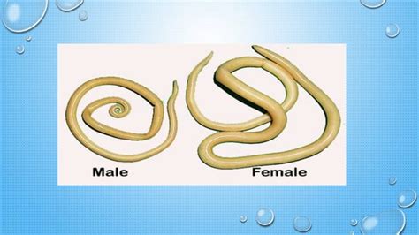 Ascariasis Disease Ppt