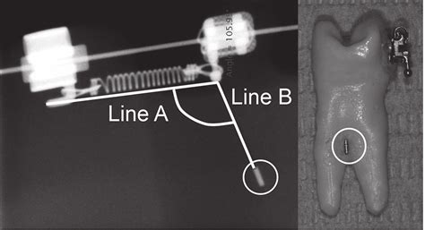 Metallic Marker And Digital X Ray The Metallic Marker In The White Download Scientific