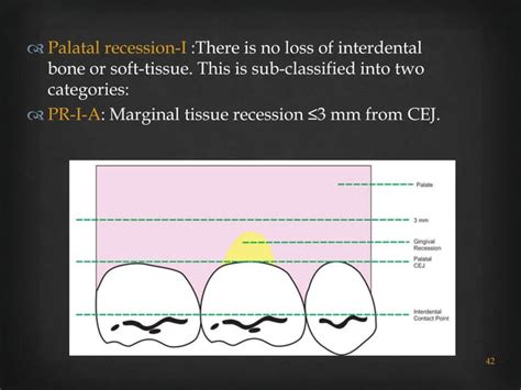 Gingival Recession Classifications Pptx Dental Health Diseases And Conditions