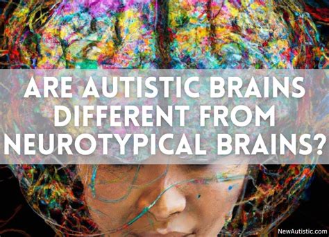 Are Autistic Brains Different From Neurotypical Brains