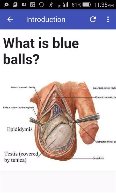 The Blue Balls Condition