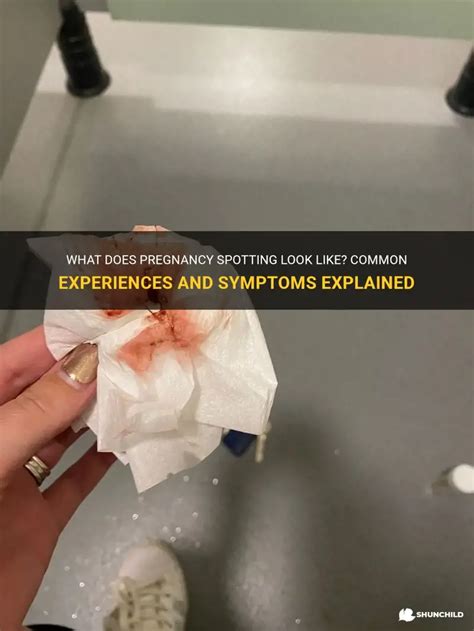 What Does Pregnancy Spotting Look Like Common Experiences And Symptoms